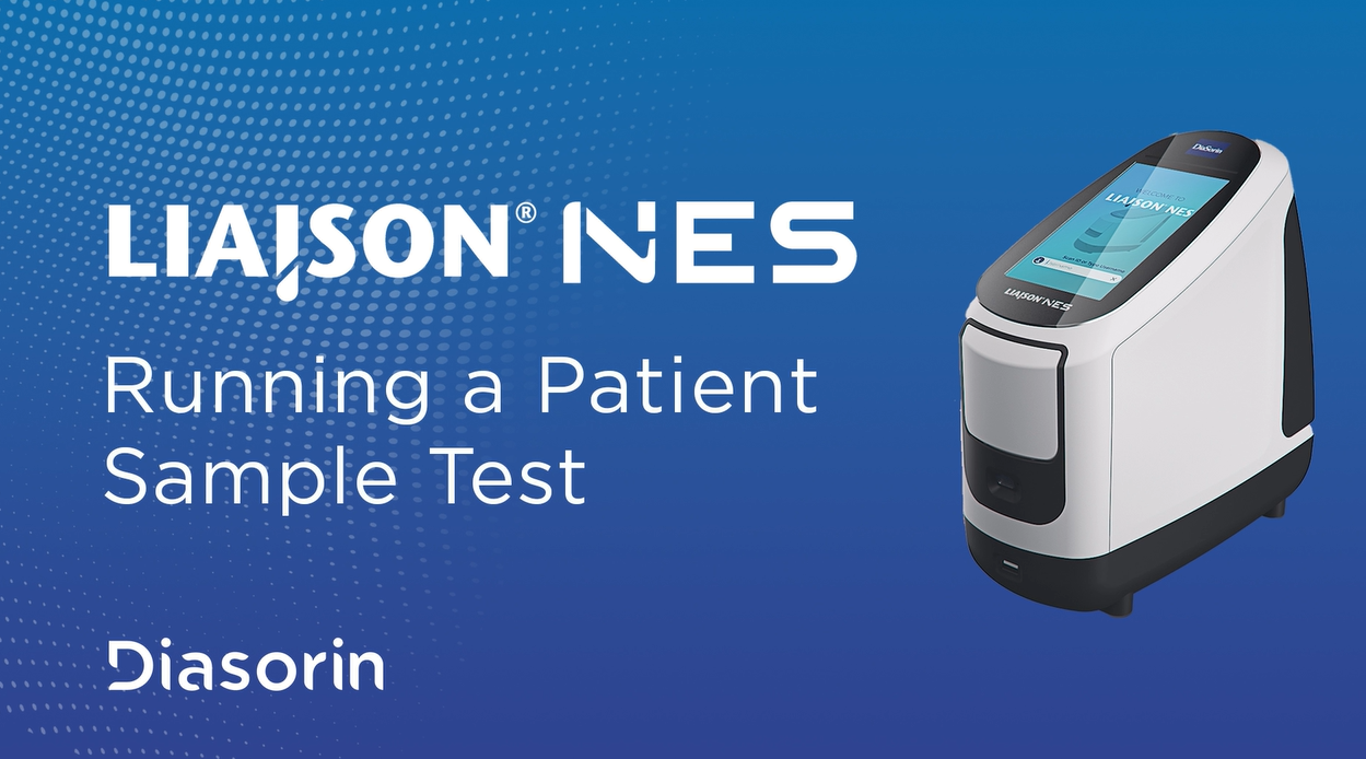 LIAISON NES | Diasorin